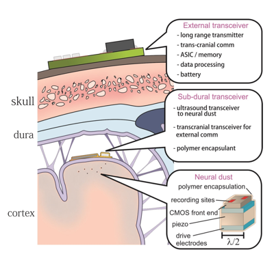 Your Future Brain-Machine Implant: Ultrasonic Neural Dust | TIME.com